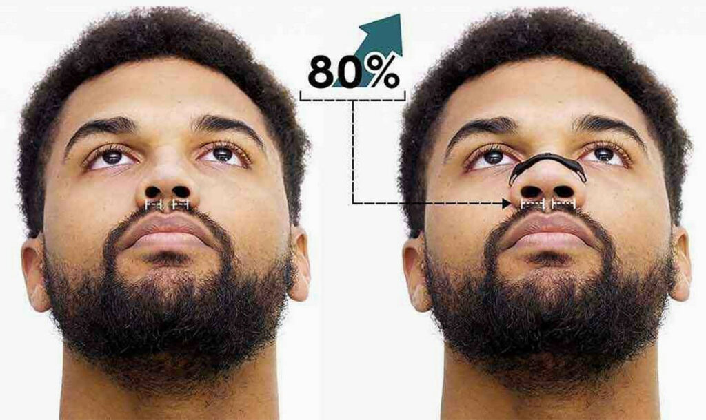 Intake Nasal Strip Review - Latest Research Include | The Daily World